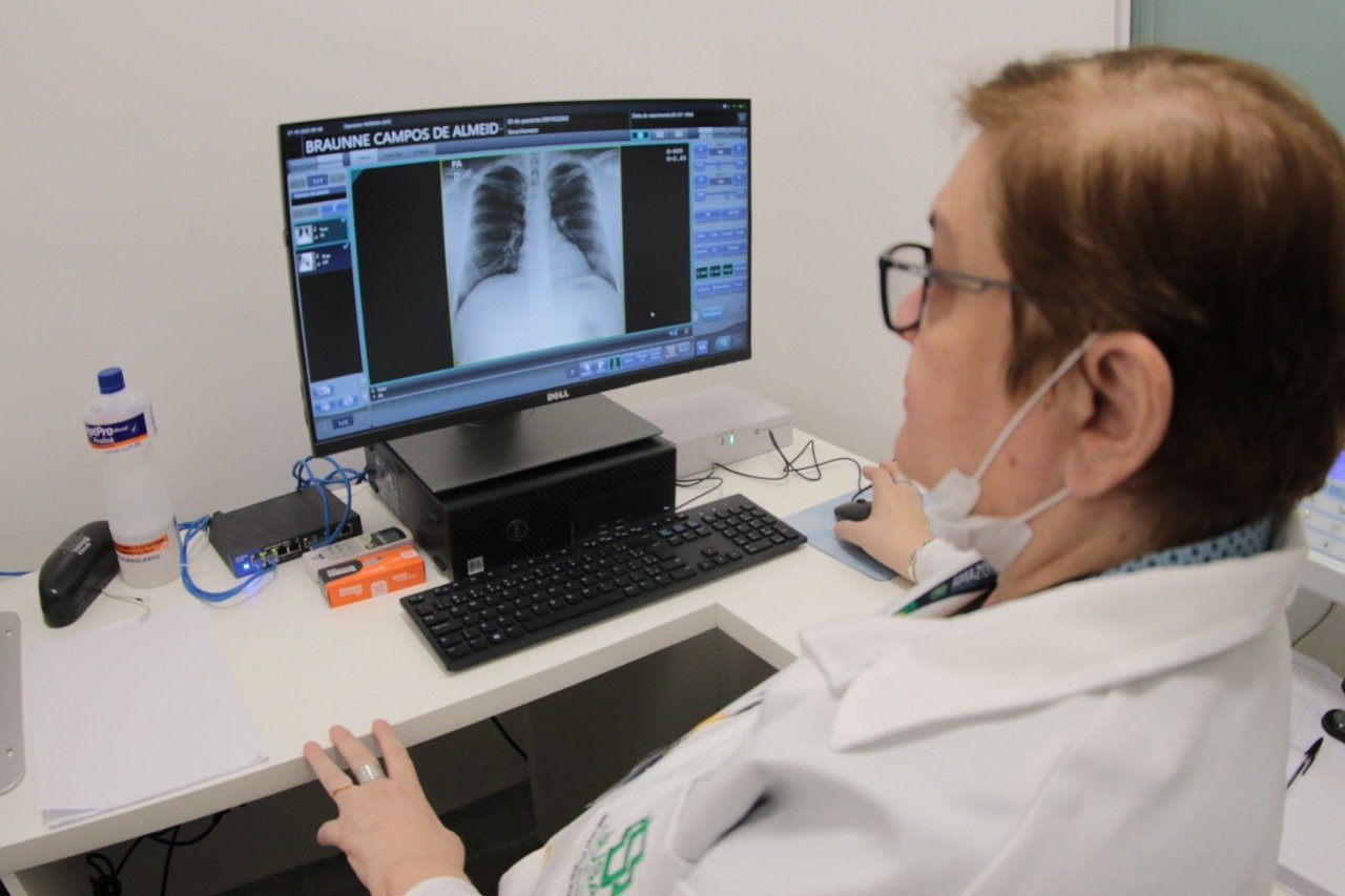 SPA Alvorada recebe novo aparelho de raio-X - Portal Você Online